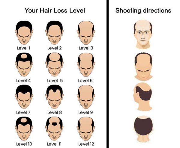 Hair Analysis - Medicana Healthpoint